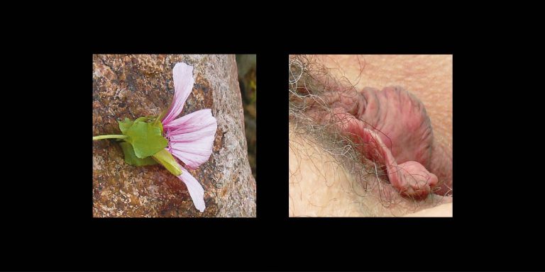 Vielfalt der Vulva: Sieht meine Vagina normal aus? • Mami rocks